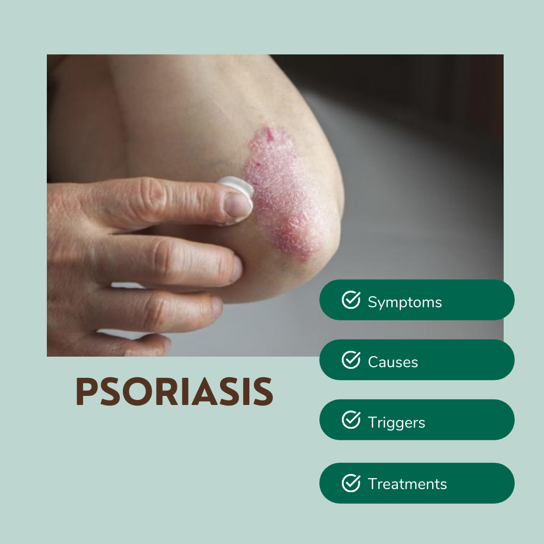 Is Psoriasis Contagious and hereditary? (+ Other FAQs) – TriDerma Singapore
